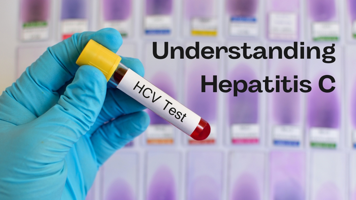 Hepatitis C Virus Can Be Completely Cured with Medication | The HIV Map.